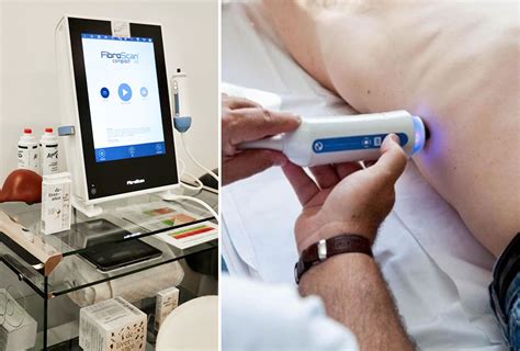 How Healthy Is Your Liver Now Theres A Lunchtime Liver Scan Thatll