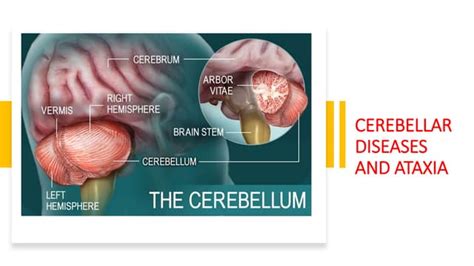 Cerebellar Diseases And Ataxiapptx