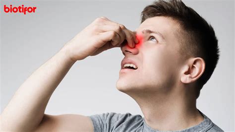Bahaya Polip Hidung Penyebab Tanda Gejala Dan Pengobatan Biotifor