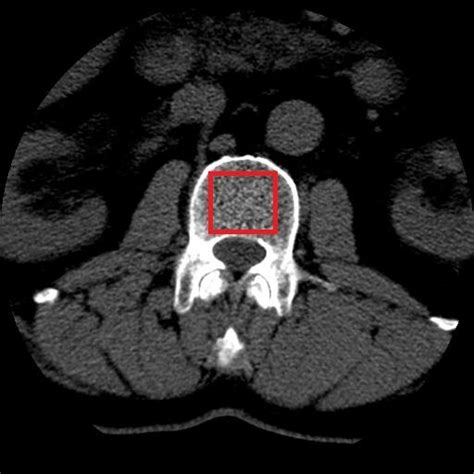 Selection Of Tissue Sample Area Download Scientific Diagram