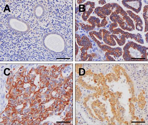 Gα13 Expression In Human Endometrial Tissues Sections Of Formalin Fixed