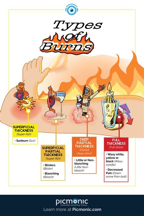 Classifications Of Burns How Are Burn Injuries Classified Law
