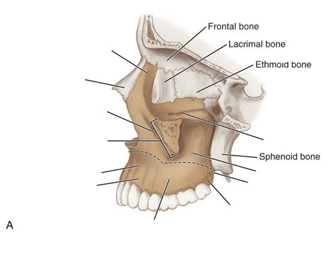 Chapter 3 Skeletal System Maxillary Structures Labeling Diagram Quizlet