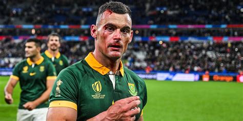 All The Best Jesse Kriel Recovering Post Thumb Surgery [photos]