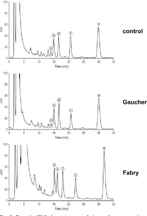 Ceramide Trihexoside Semantic Scholar