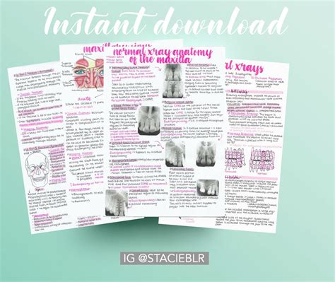 Oral Radiology Note Set Etsy