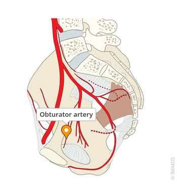 Obturator Arterie