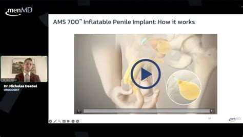 The Modern Penile Implant How Todays Ipp Technology Restores Sexual