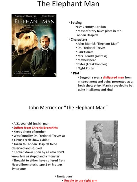 Elephant Man Disease Explained Syndrome Delephant Man Qgwr