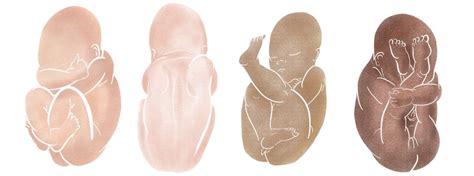 Vimeo Archives Breech Birth Network