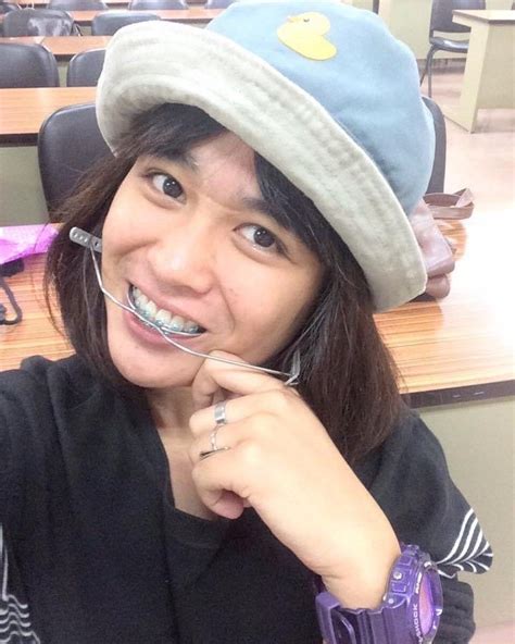 Headgear Thailand On Instagram Cute Braces Headgear Woman In Suit