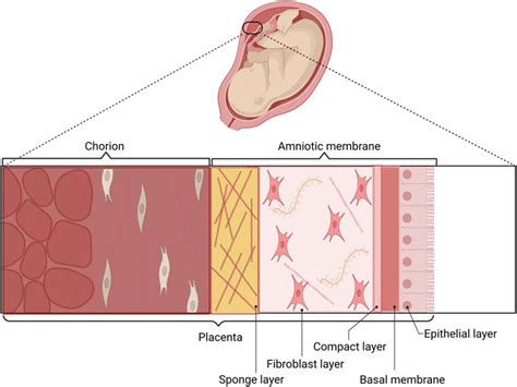 Medical Term For Surgical Puncture Of The Amniotic Sac At John Keys Blog