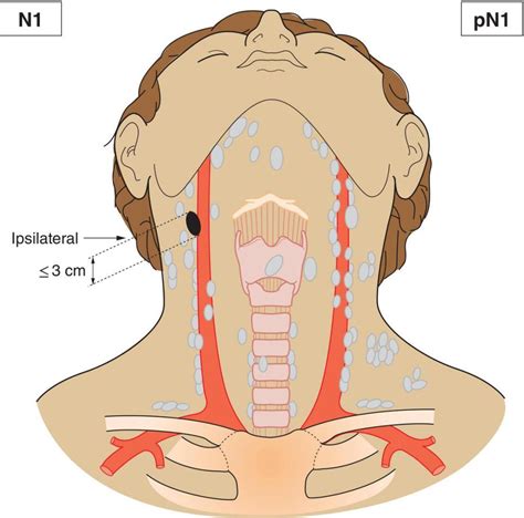 Of Skin Of The Head And Neck Icd‐o‐3 C440 C4424 Oncohema Key