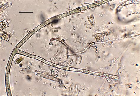 Fifth Columnists Microscopesandmonsters