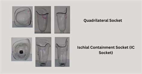 Prosthetic Socket Explained Types Process Solutions And More