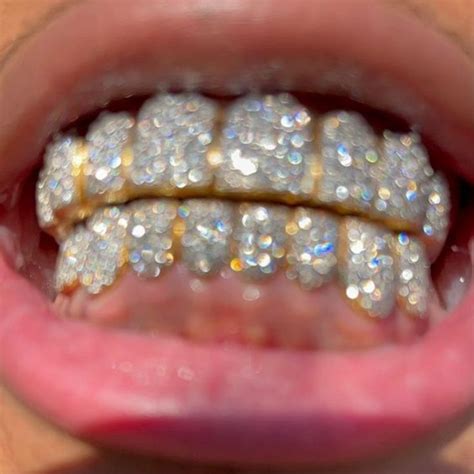 I Clarity Diamond Grill Protective White Gold 18kt 8 Top