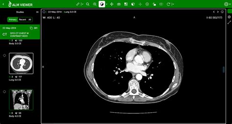 unveiling the future of radiology cutting edge dicom viewer technology