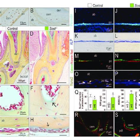Sost Deletion Causes A High Bone Mass Phenotype In Mandible
