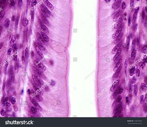 Simple Columnar Epithelium Small Intestine