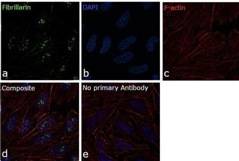 Fibrillarin Monoclonal Antibody J995 Invitrogen 100 μl