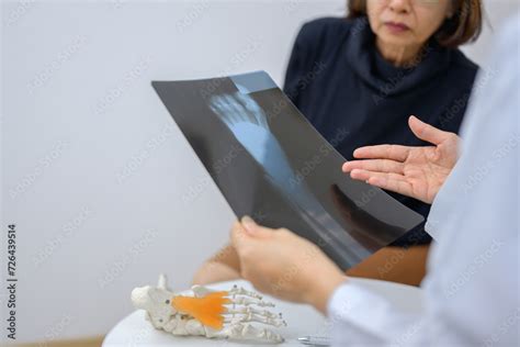 An Orthopedic Doctor Holding An X Ray Sheet Of Ankle And Foot Bones Is