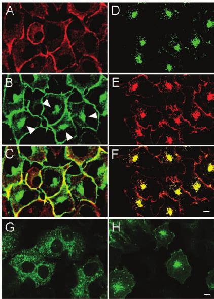 Colocalization Of Psma With Filamin A And Localization Of Internalized