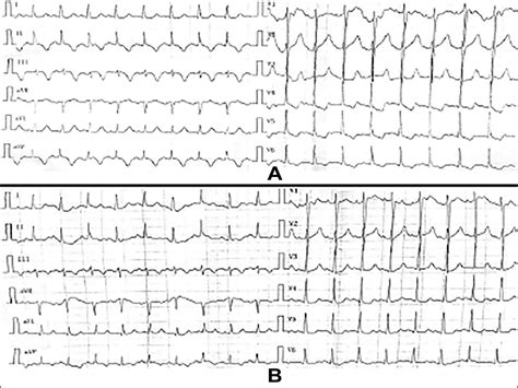Jcpsp Journal Of College Of Physicians And Surgeons Pakistan