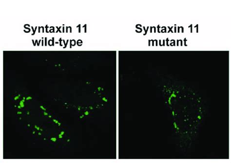 Syntaxin 11 Is Not Membrane Anchored By The Cysteine Rich Download