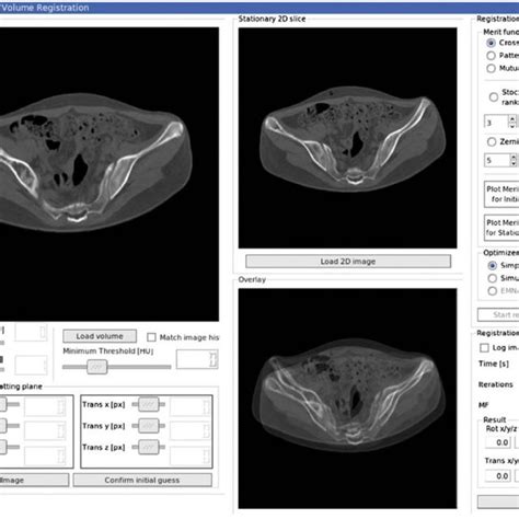 The Primary Survey The Mnemonic Abcde Is Used To Remember The Order Of