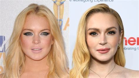 How Lindsay Lohans Face Has Transformed Over The Years According To