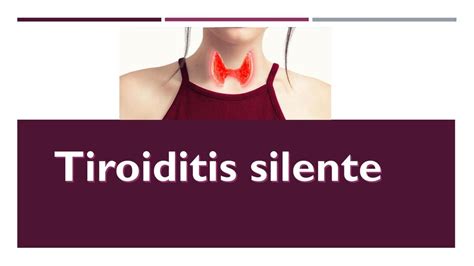 Tiroiditis Silente Alexandra Puma Udocz