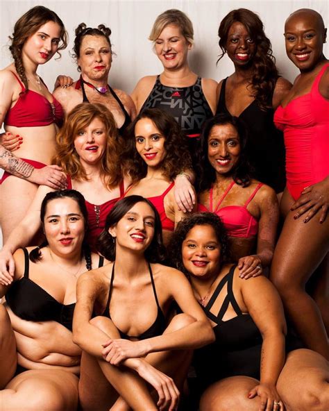 Love Disfigure Γυναίκες με σοβαρές δερματικές παθήσεις σε μια καμπάνια