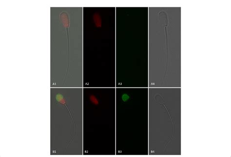 Sperm With A Disrupted Plasma Membrane Dead Propidium Iodide