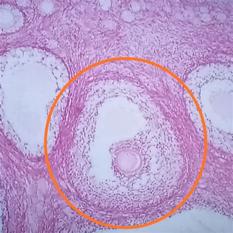 Ilustra 231 227 O Do Sistema Reprodutor Feminino Com Flores Vetor Gr