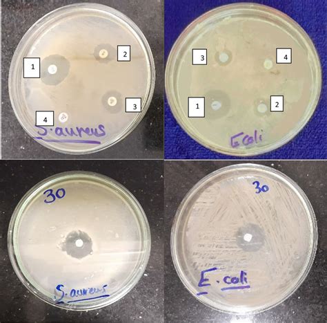 Antimicrobial Activity Of Four Antibiotics 1 Novobiocin 2 Neomycin