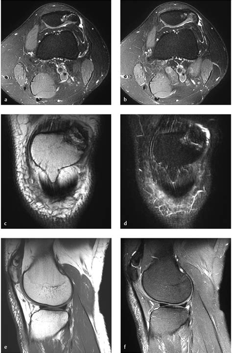 Part 4 Lower Extremity Radiology Key