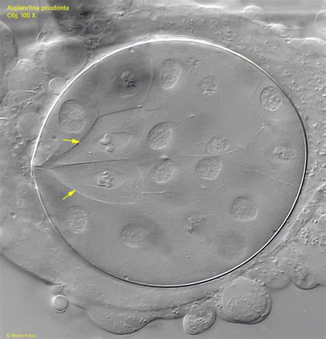 Asplanchna Priodonta Real Micro Life