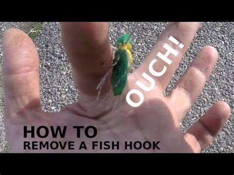 OUCH How To Remove A FISHING HOOK In The Field EASY FISH HOOK REMOVAL Ouch Fish Hook