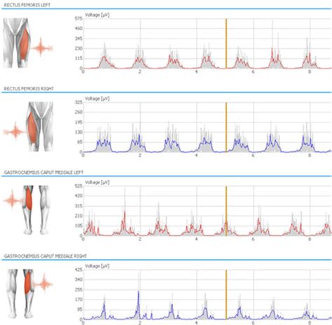 Professional Use Kurage