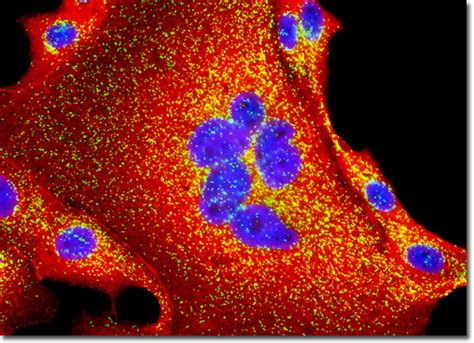 Molecular Expressions Microscopy Primer Specialized Microscopy