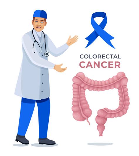 1 300 Colorectal Cancer Stock Illustrations Graphiques Vectoriels