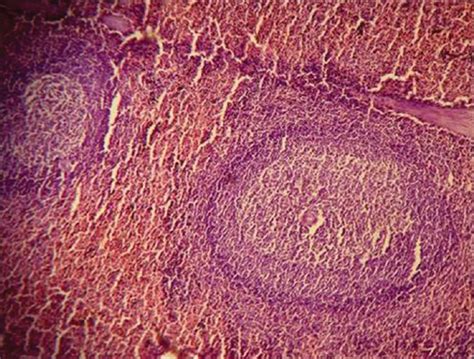 Immunotoxic And Genotoxic Potential Of Arsenic And Its Chemical Species
