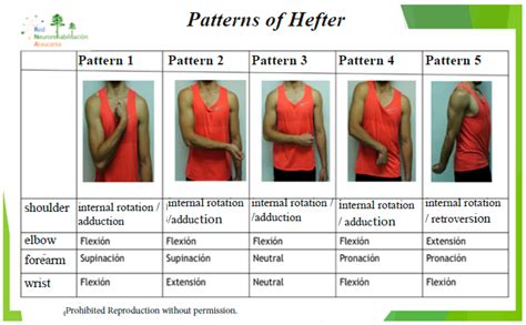 Upper Limb Spasticity