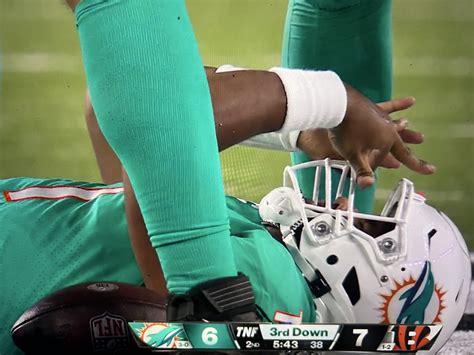 Decorticate Response