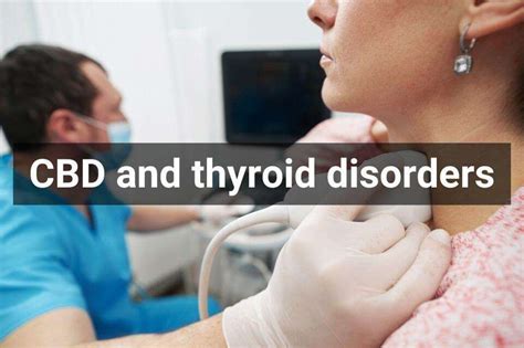 Cbd And Thyroid Disorders How It Helps