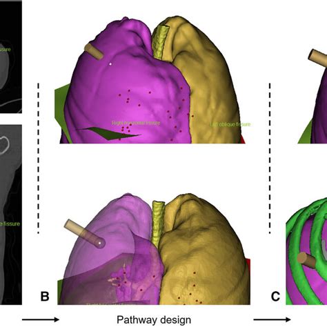 The Scheme Of Template Design A Ct Scan Showing The Location Of The