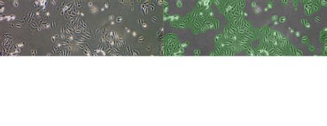 How Fit Are You In Cell Confluency Estimations