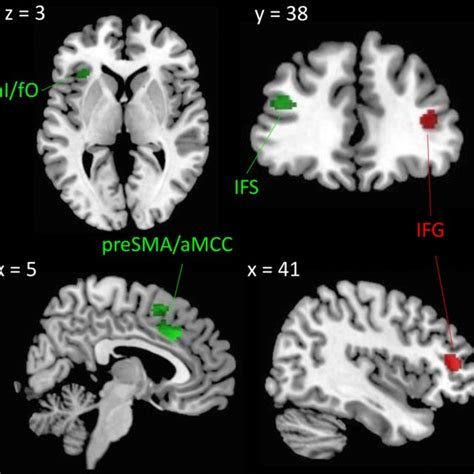 Convergence Of Brain Activation Across All Task Switching Experiments Download Scientific