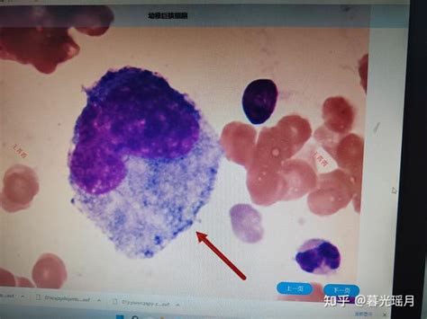 临床血液学检验技术 正常细胞形态学观察实验报告 红蓝铅笔 知乎