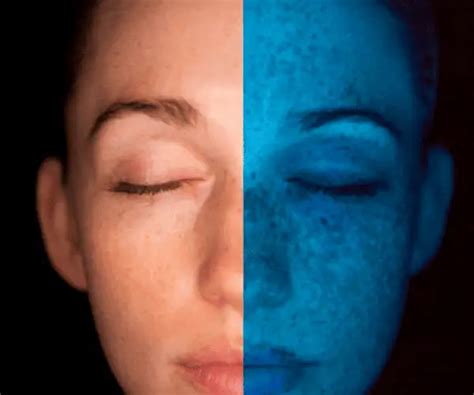 Dermascan Clínica Mezz